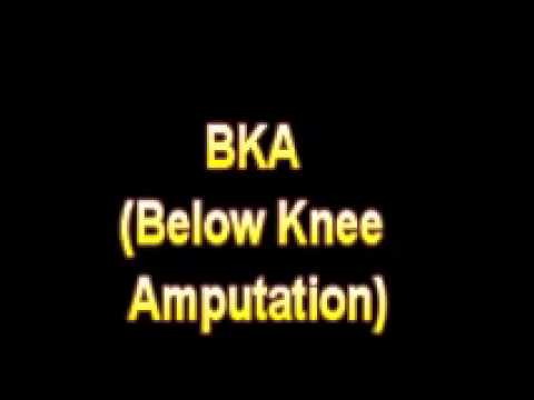 What Is The Definition Of BKA (Below Knee Amputation) Medical Dictionary Free Online