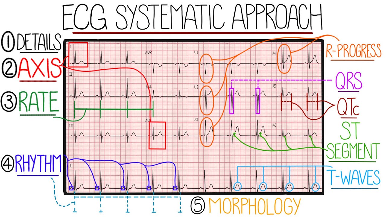 Mastering ECG Interpretation: A Comprehensive Guide | Galaxy.ai