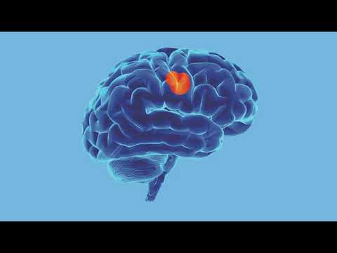 Thermal Ablation Surgery for Seizures (LITT)