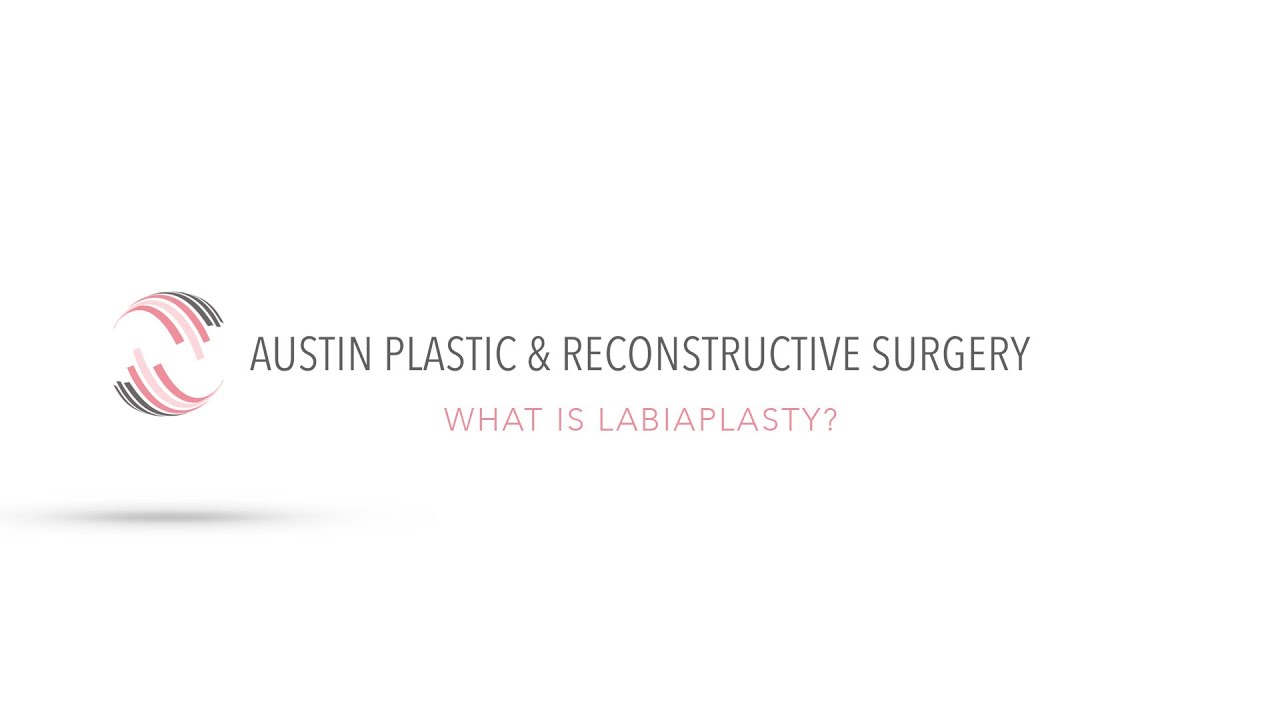 WHAT IS LABIAPLASTY?