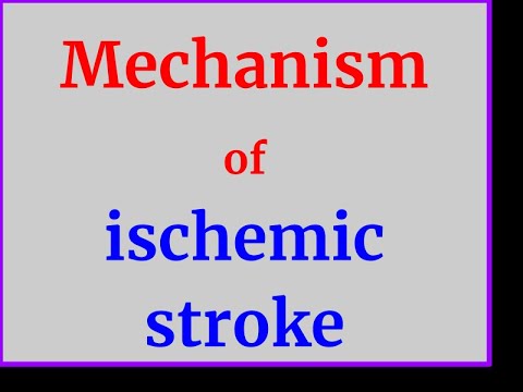 Mechanism of ischemic stroke