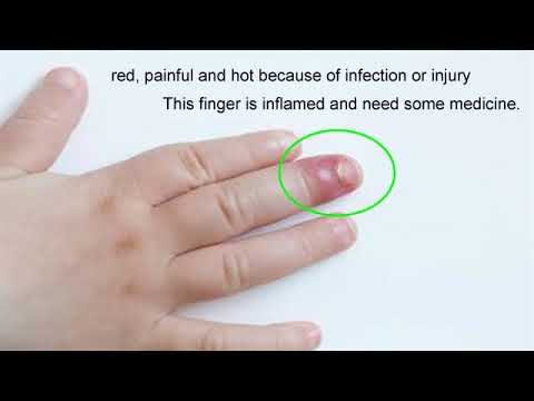 inflamed meaning | Vocabulary for Kids | Children's Dictionary | Learn English Vocabulary