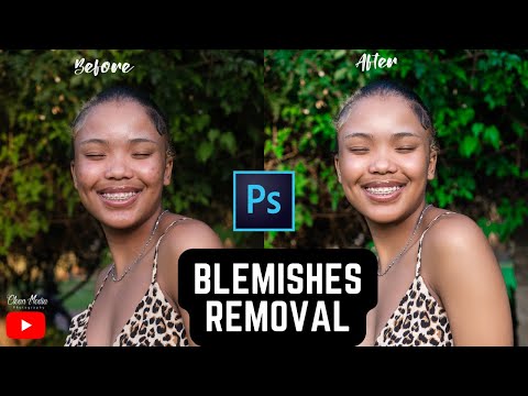 How to Remove Blemishes and Acne (Fast Tutorial) 2023