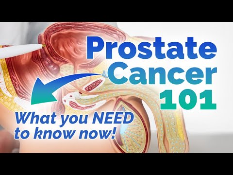What You Need To Know About Prostate Cancer