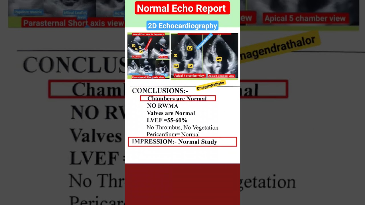 Normal Echo report l नॉर्मल इको रिपोर्ट l खुद अपना इको रिपोर्ट देखे #echo #heart #shorts