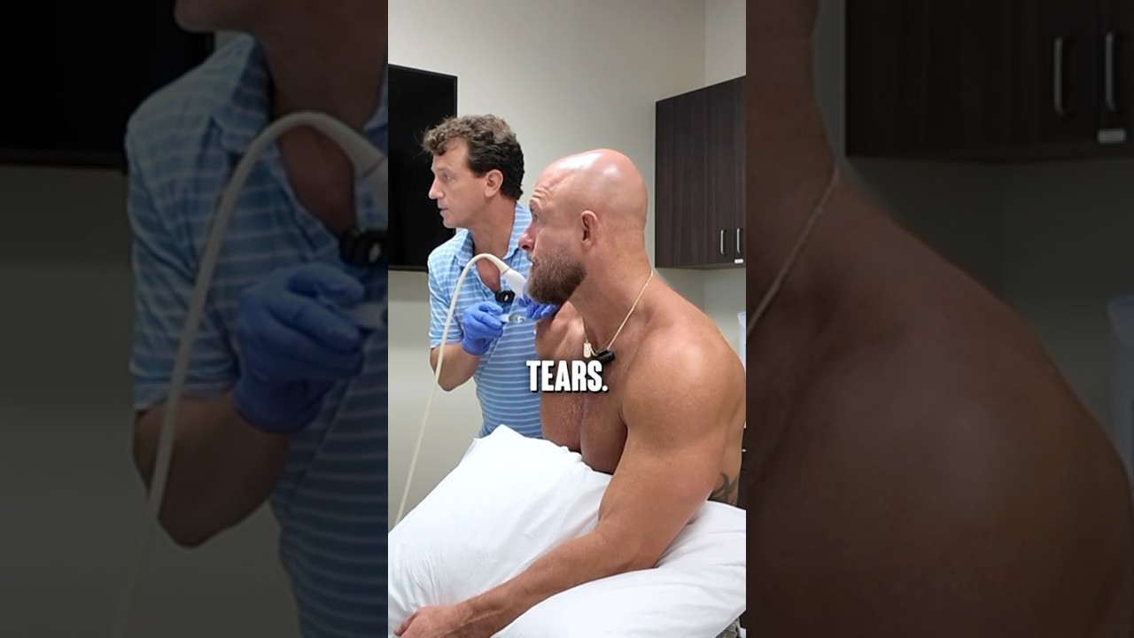 Hidden Rotator Cuff Tear Revealed — MRI Missed It!