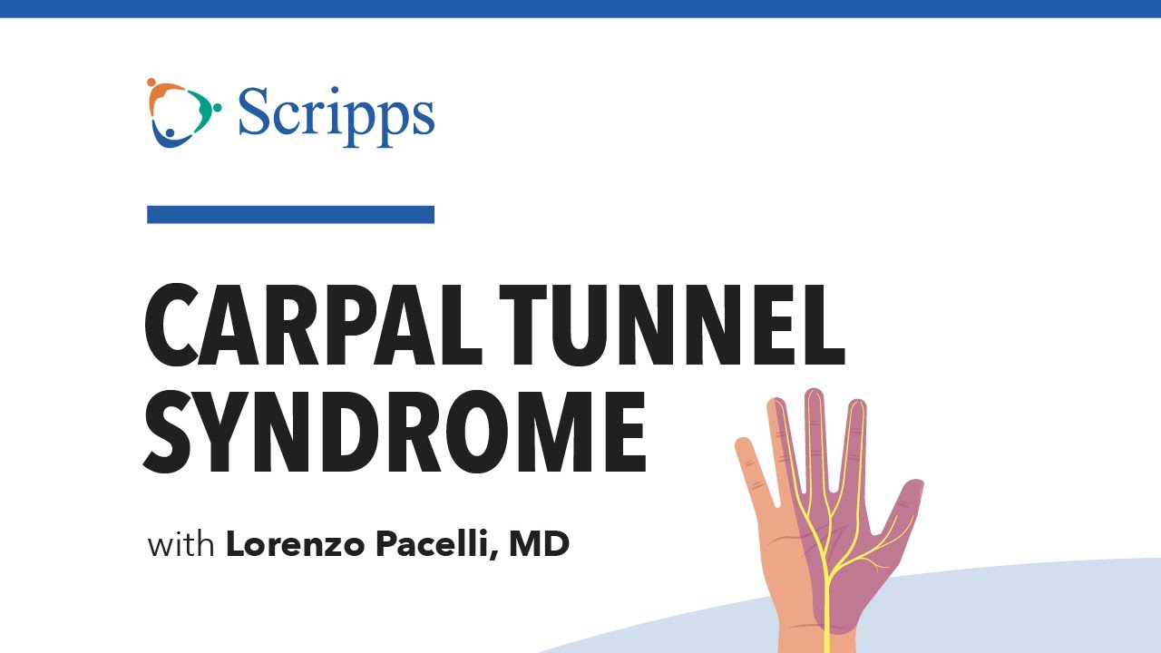 CTS: Symptoms and Treatments of Carpal Tunnel Syndrome with Dr. Lorenzo Pacelli | San Diego Health