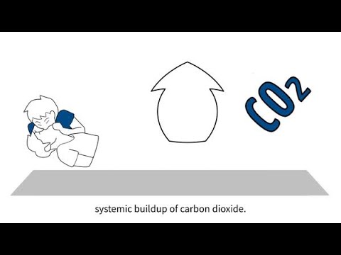 MedEd capnography byte 10: Return of spontaneous circulation (ROSC)