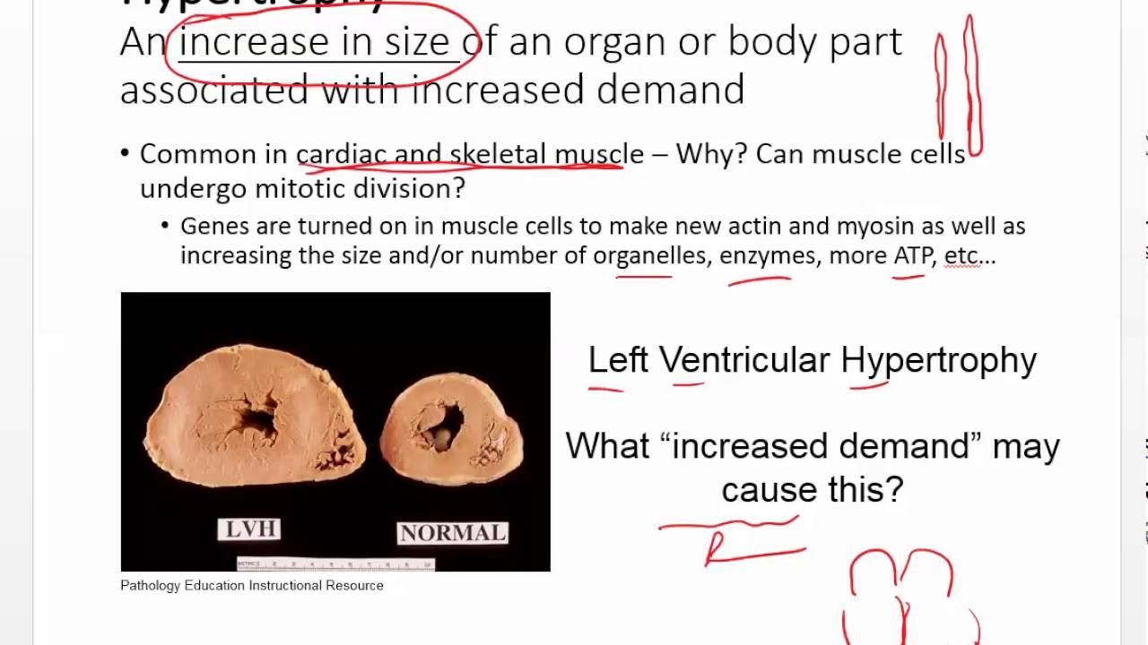 Pathophysiology -  Cell stress and injury -Ch2