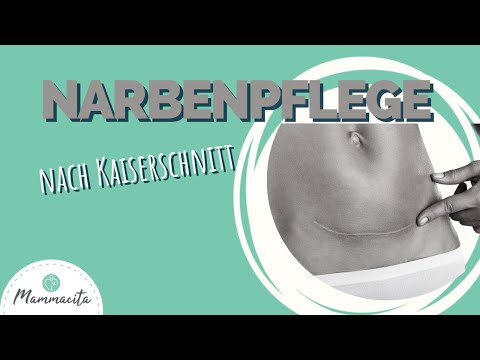 So pflegst du deine Narbe nach dem Kaiserschnitt richtig | Tipps Kaiserschnitt