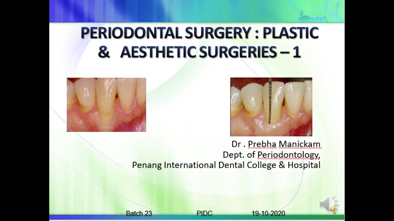 PERIODONTAL SURGERY: PLASTIC & ESTHETIC SURGERY PART -1