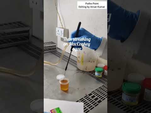Urine Culture Procedure 🧫