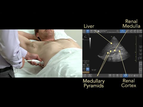 Stanford Doctor: Point of Care Kidney and Bladder Ultrasound
