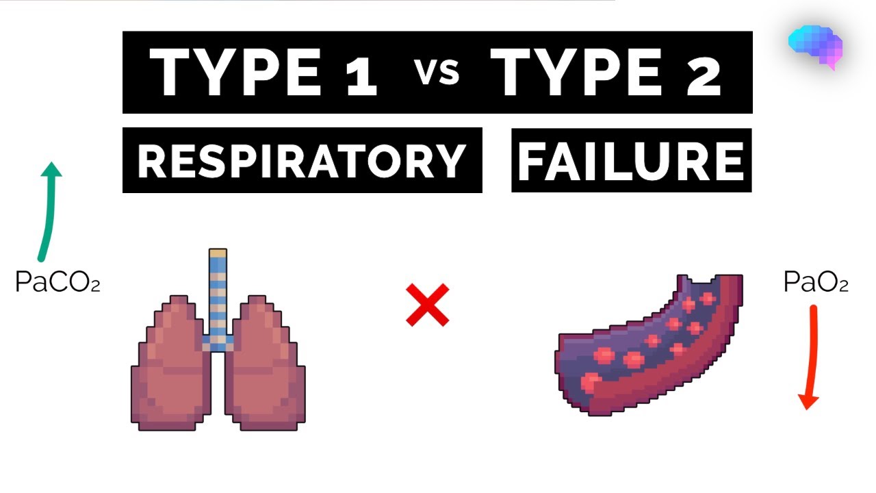 Type 1 vs Type 2 Respiratory Failure | ABG Interpretation | UKMLA | CPSA | PLAB 2