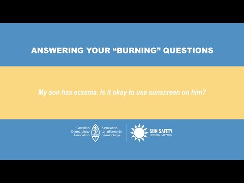 CDA's Dr. Sophia Colantonio answers a "burning" question.