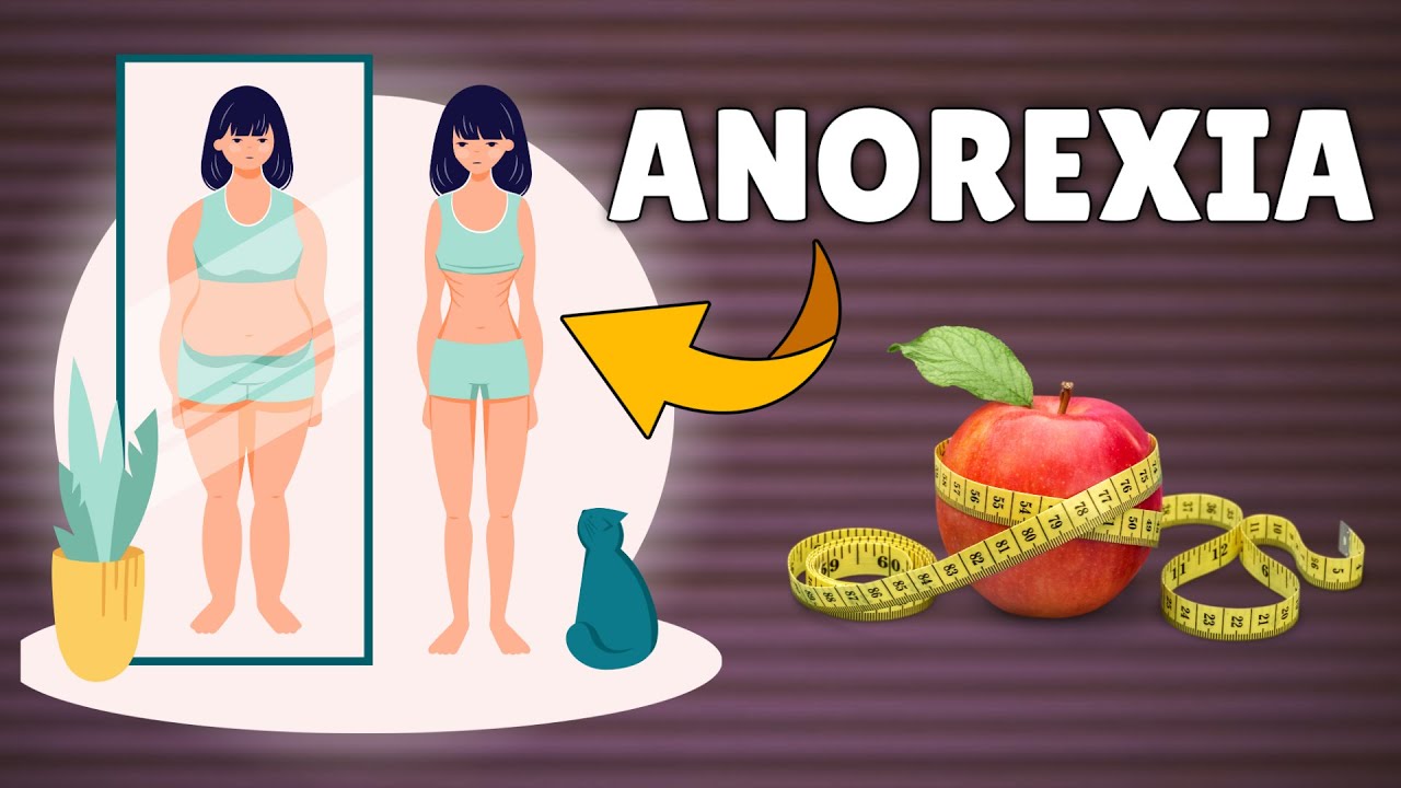 ⚠️ANOREXIA | SÍNTOMAS, CAUSAS y TRATAMIENTO