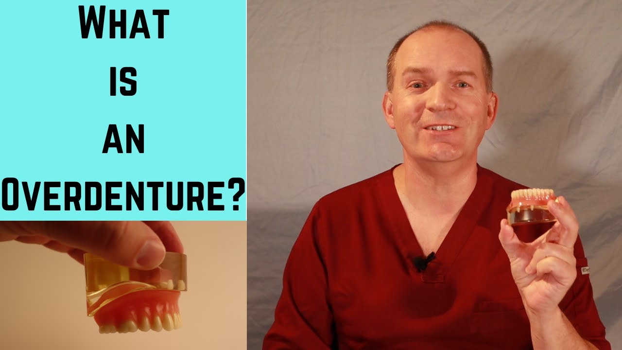 What is an Overdenture? What is a snap in denture?