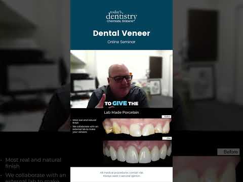 Examples of Porcelain Veneers - Lab-Made vs CAD-CAM Porcelain Veneers