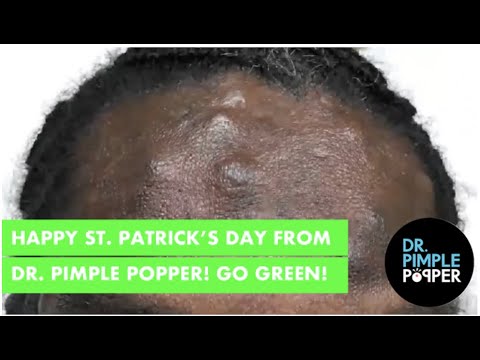 Dr. Pimple Popper Pops 'Best' Green Cysts In New Youtube Video