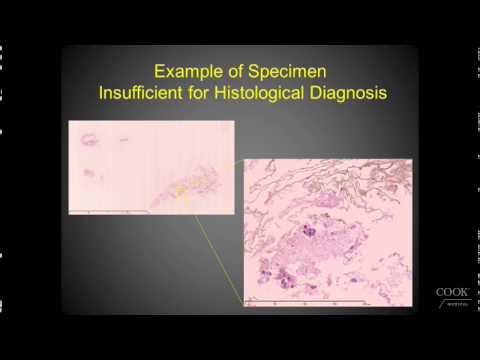 5-6 Diagnostic Degree of Samples and Quality Assessment