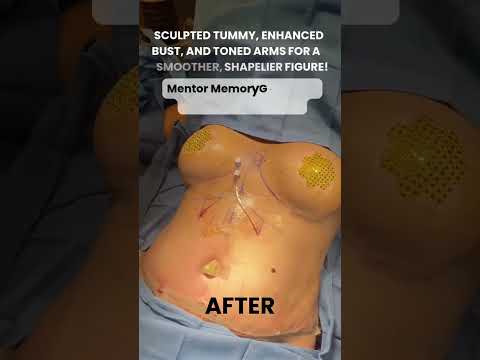 From Dr. Curtis in Stockton comes this incredible transformation!