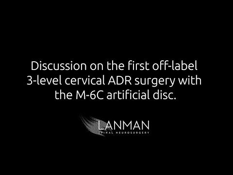 The first off-label 3-level cervical ADR surgery with the M-6C artificial disc. | Dr. Todd Lanman