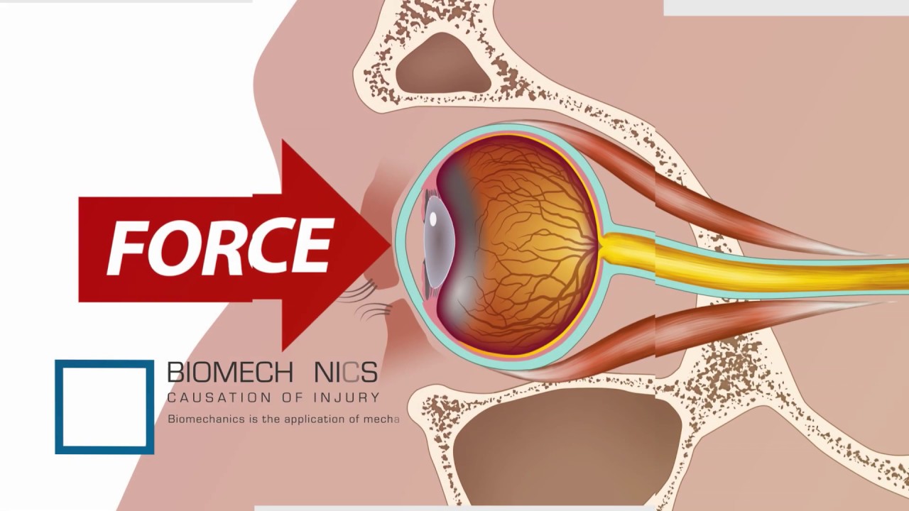 ESi: What Can We Help You With?