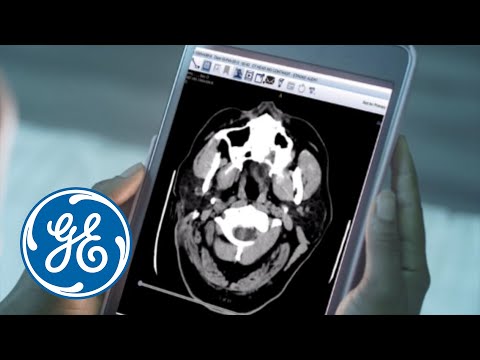 GE Healthcare Centricity Universal Viewer Zero Footprint – Sykes Woodward