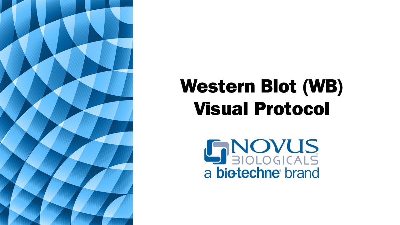 Western Blot Protocol: Tips, Techniques & Videos