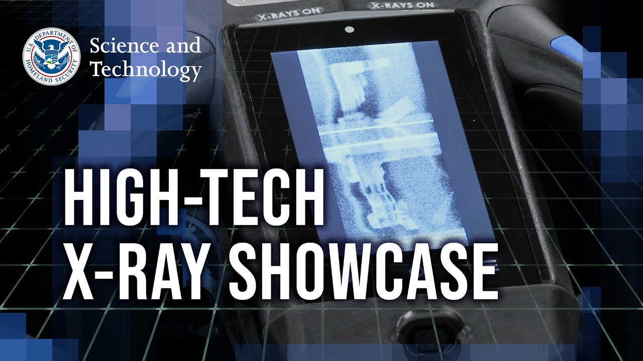 High-Tech X-Ray Showcase