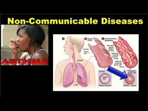 Non-communicable Diseases