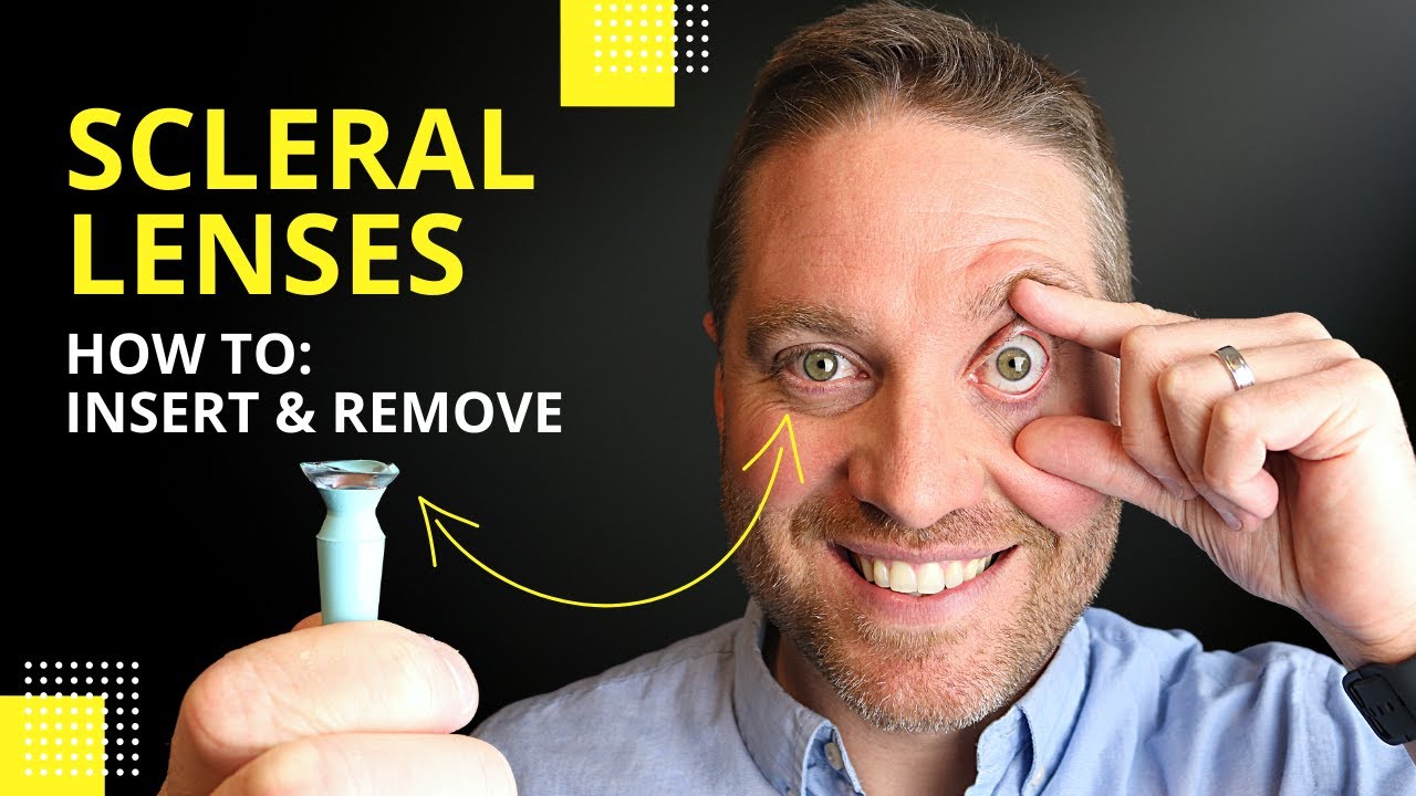 Scleral Lenses Insertion And Removal: Plus Pro Tips For Beginners!