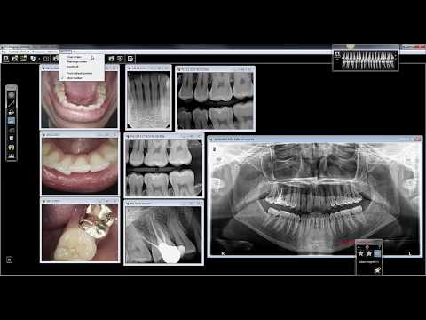 CS Imaging - Find, Open, Arrange and Present Images most efficiently
