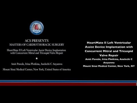 Technique for implantation of HeartMate II LVAD with concurrent mitral and tricuspid valve repair