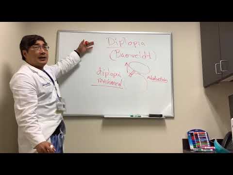 Diplopia and Baerveldt