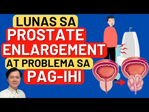Lunas sa Prostate Enlargement at Problema sa Pag-Ihi. - By Doc Willie Ong
