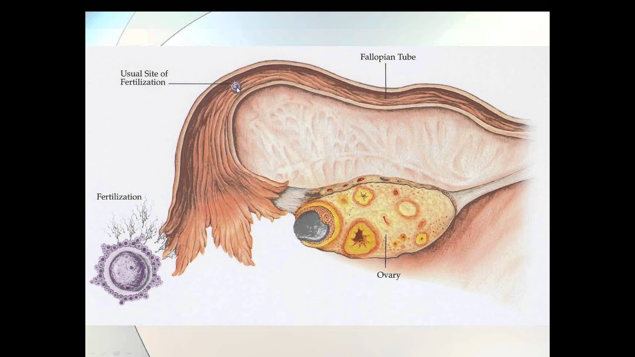 Exploring Surrogacy Options - Webinar for U.S. Intended Parents