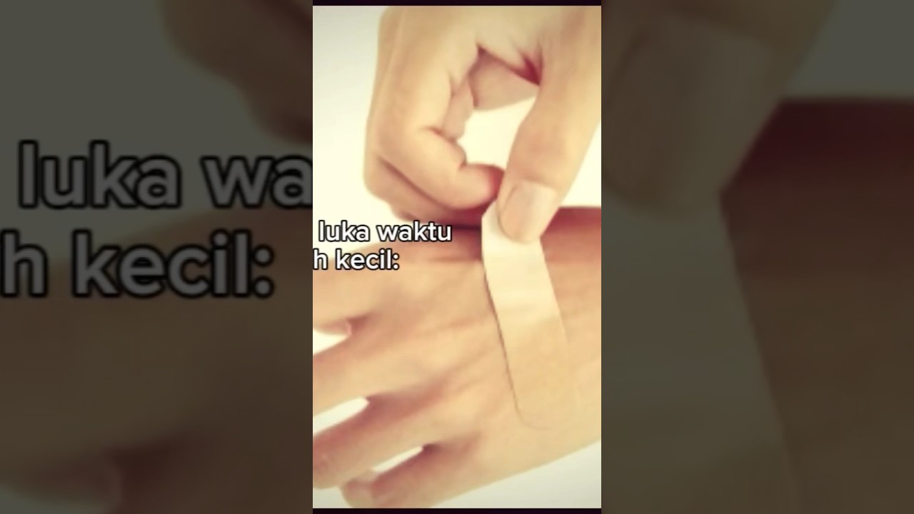 obatin luka dulu&sekarang? #gmmtv #myschoolpresident #head2head #badbuddy #theheartkillers