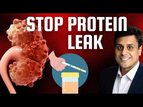 How to reduce PROTEIN LEAK in URINE and slow KIDNEY DISEASE #proteinuria #hindi