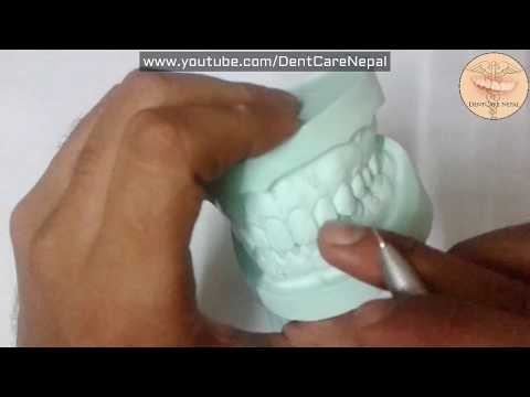 Tooth Numbering System - FDI Tooth Numbering System