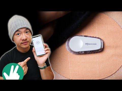 Dexcom G6: The most important tech in my life