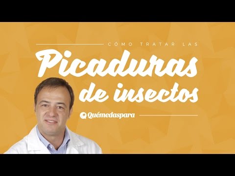 Cómo tratar las picaduras de insectos