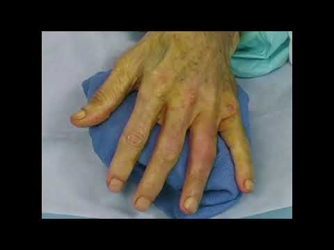 #063 Digital Nerve Block Technical Procedure | Reviewed by Elsevier | Cheap Ebooks