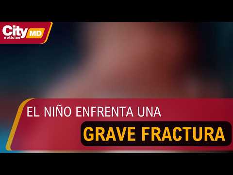 Niño terminó enyesado del pecho a las piernas tras presunta lesión en ...