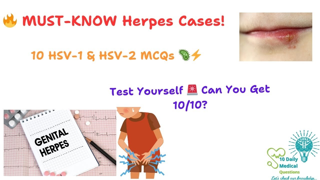 HERPES SIMPLEX VIRUS CASE QUIZ! 🚨 Can You Get 10/10? (HSV 1 & HSV 2)