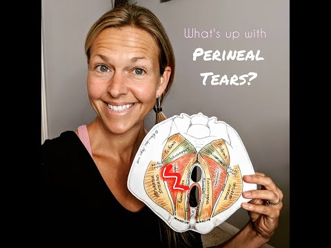 What's up with Perineal Lacerations? (Tearing during birth)