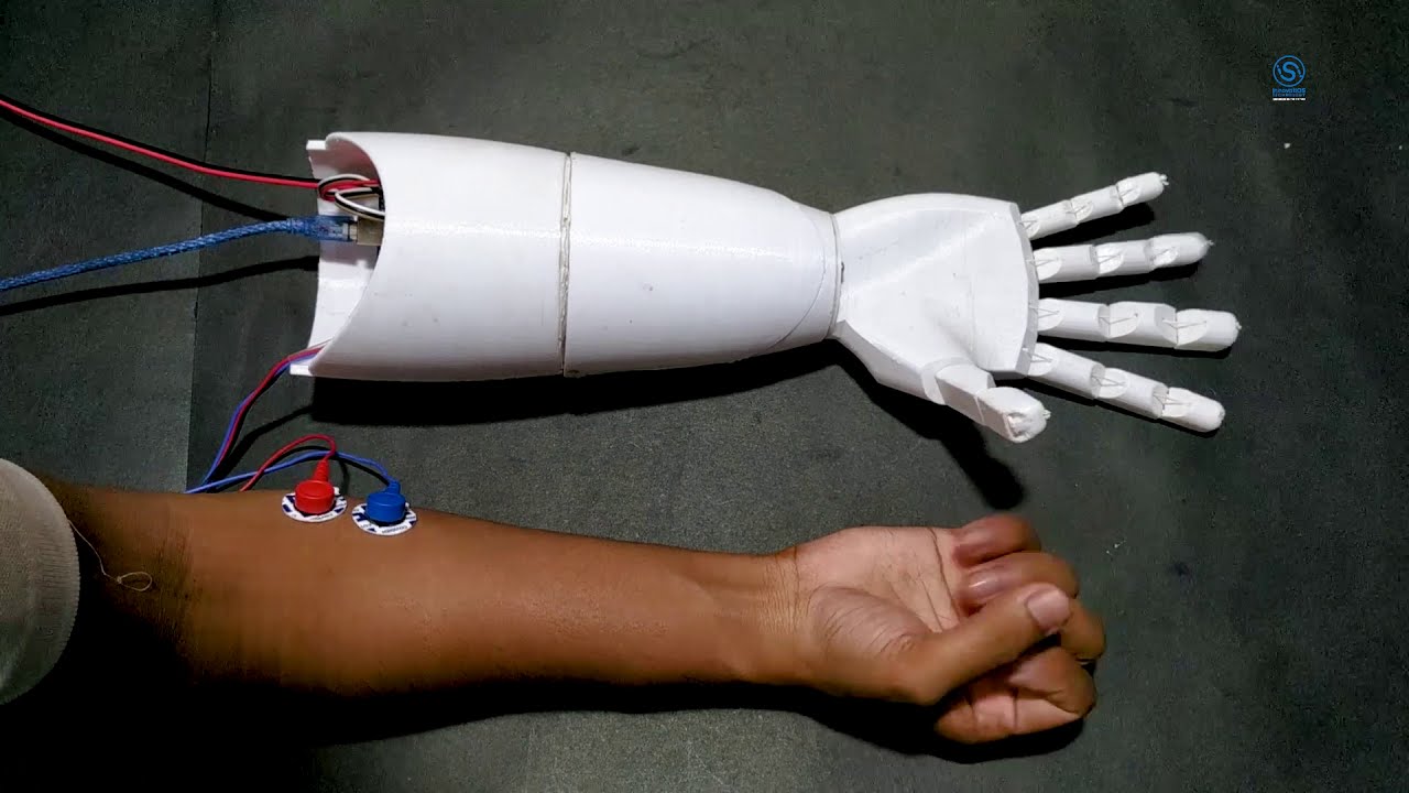 Electromyography Emg Robotic Prosthetics Arm Element14 Community