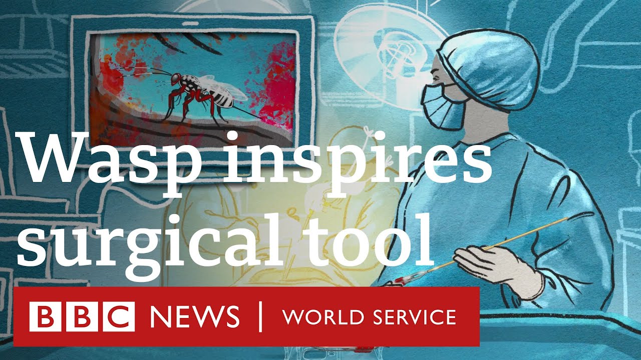 The new surgical tool inspired by a wasp - BBC World Service