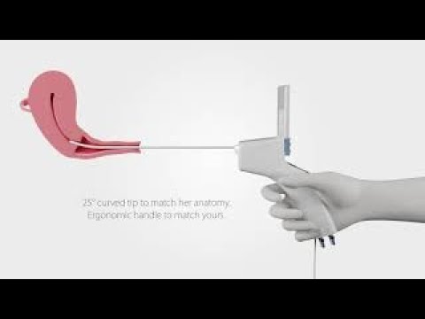 LiNA OperåScope™ Single-Use Operative Hysteroscopy System - LiNA Medical
