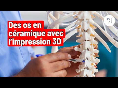 Il crée des os en impression 3D !